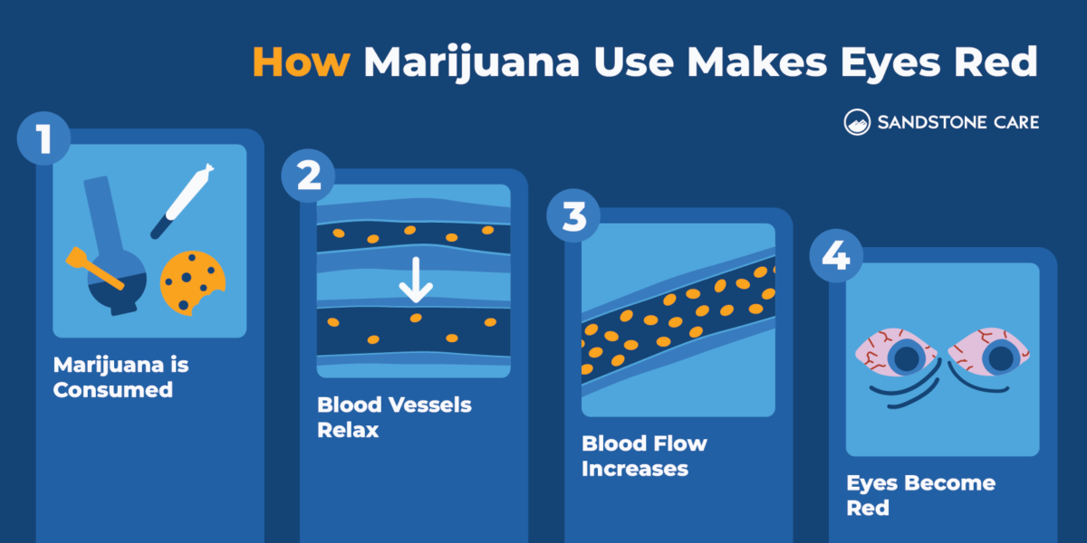 High Eyes | Causes, Symptoms, and How to Address Them