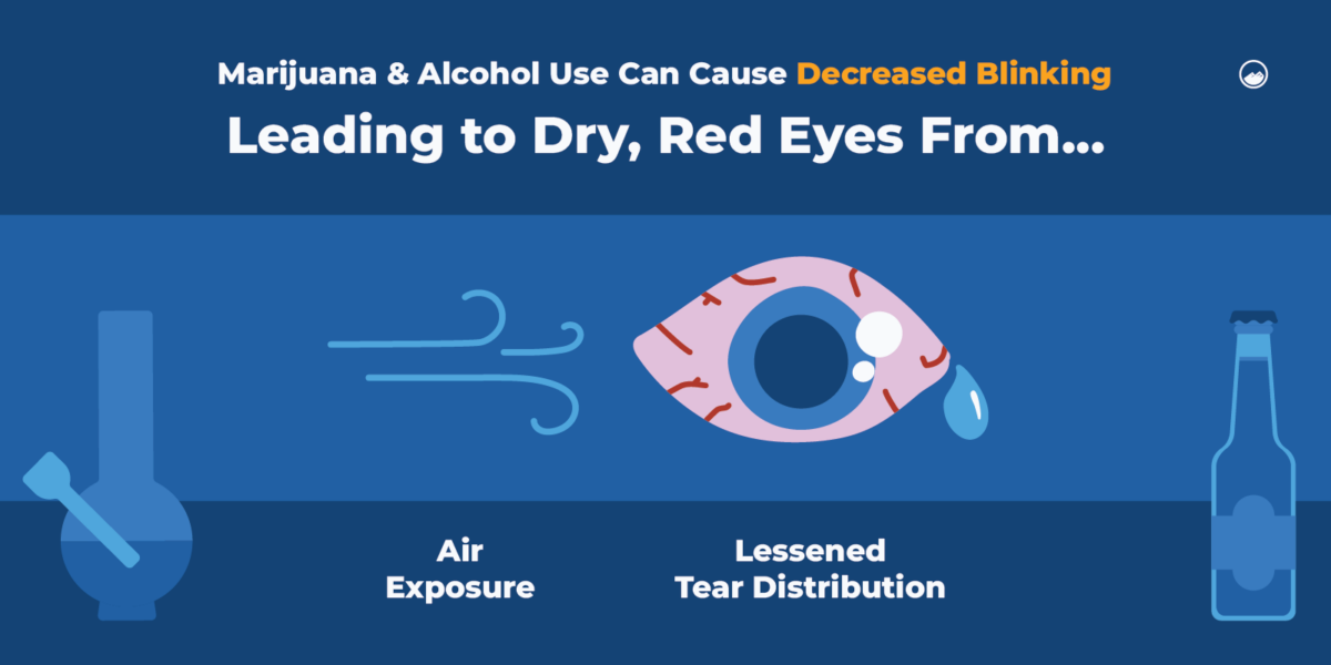 High Eyes | Causes, Symptoms, and How to Address Them