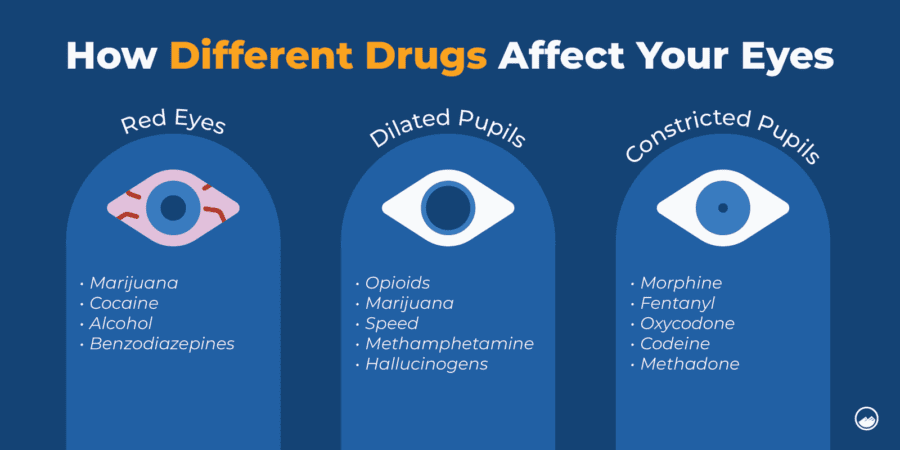 High Eyes | Causes, Symptoms, and How to Address Them