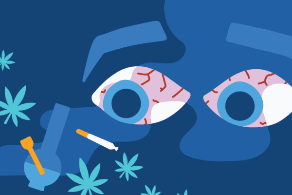 High Eyes | Causes, Symptoms, and How to Address Them