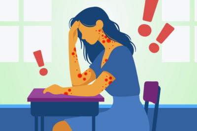 Stress Rash: 3+ Causes, Symptoms, and How to Make it Stop