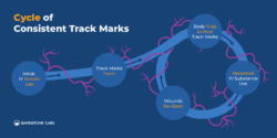 Track Marks | What They Look Like and How to Recover