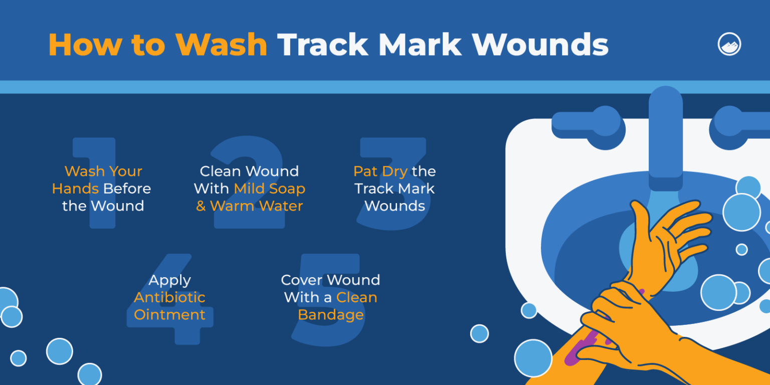 Track Marks | What They Look Like and How to Recover