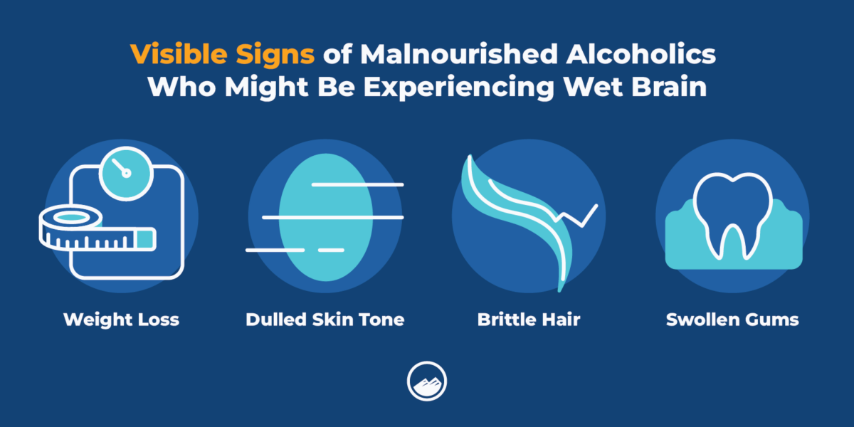 Wet Brain | A Guide to Wernicke-Korsakoff Syndrome